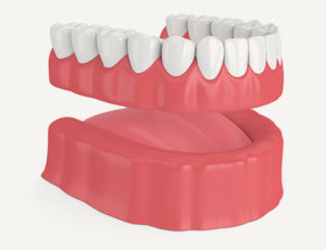 Dentures Vancouver | Removable Dentures | Nest Dental